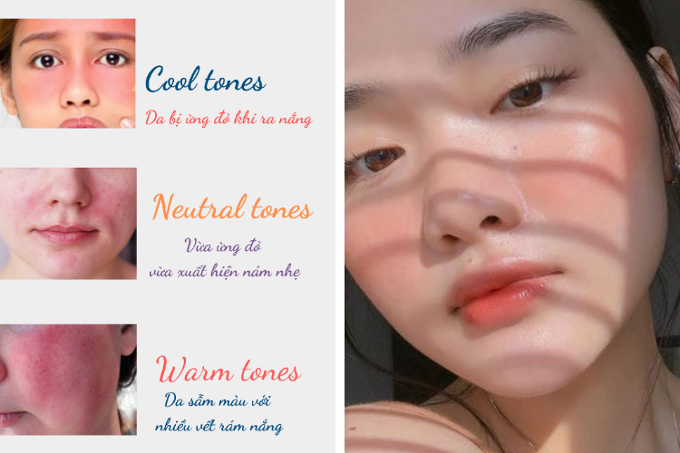 Da tone lạnh hợp với màu gì để làm NỔI BẬT màu da của bạn